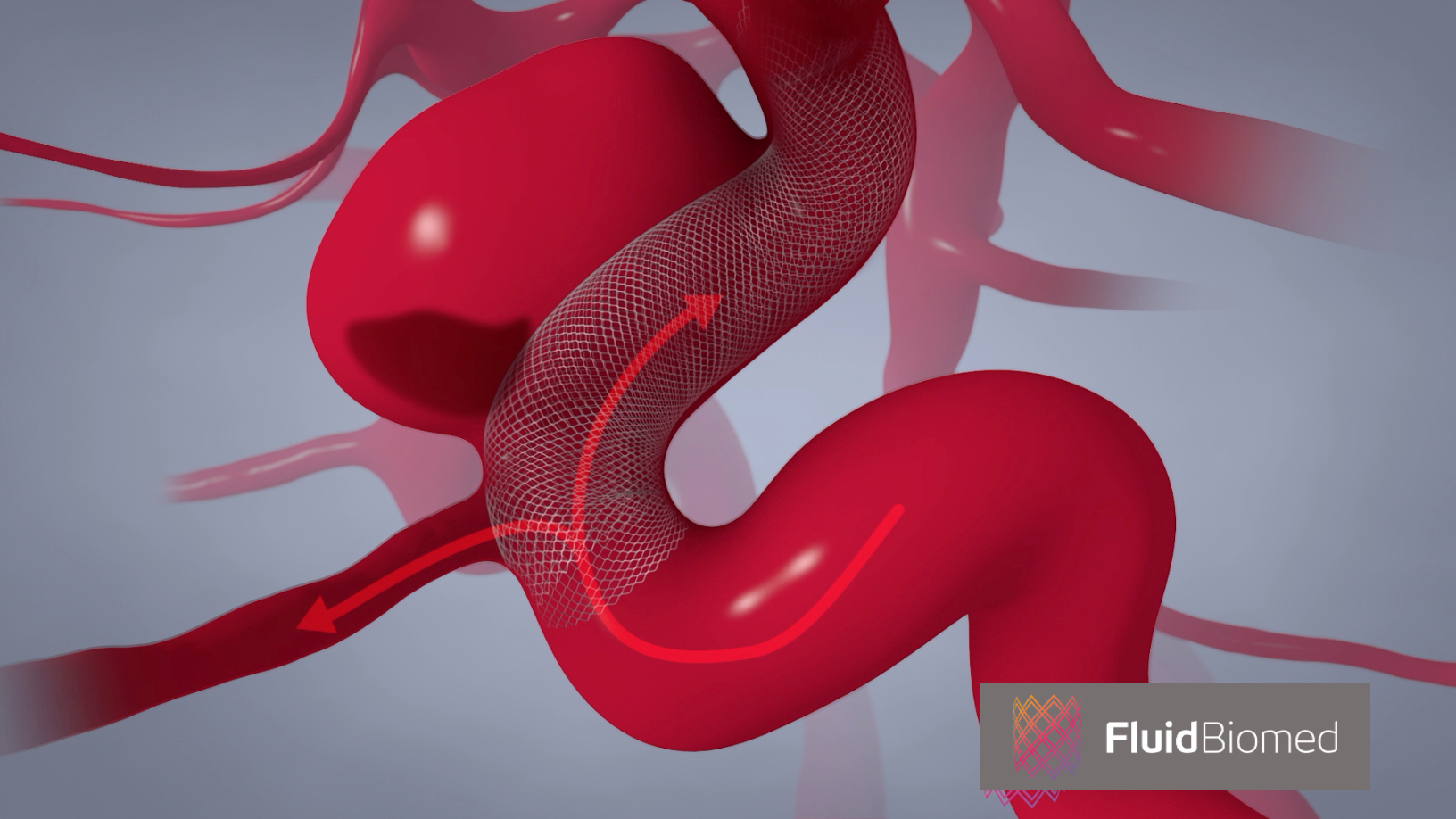 Six Pivotal Developments in Stroke Treatment and Care | arch magazine